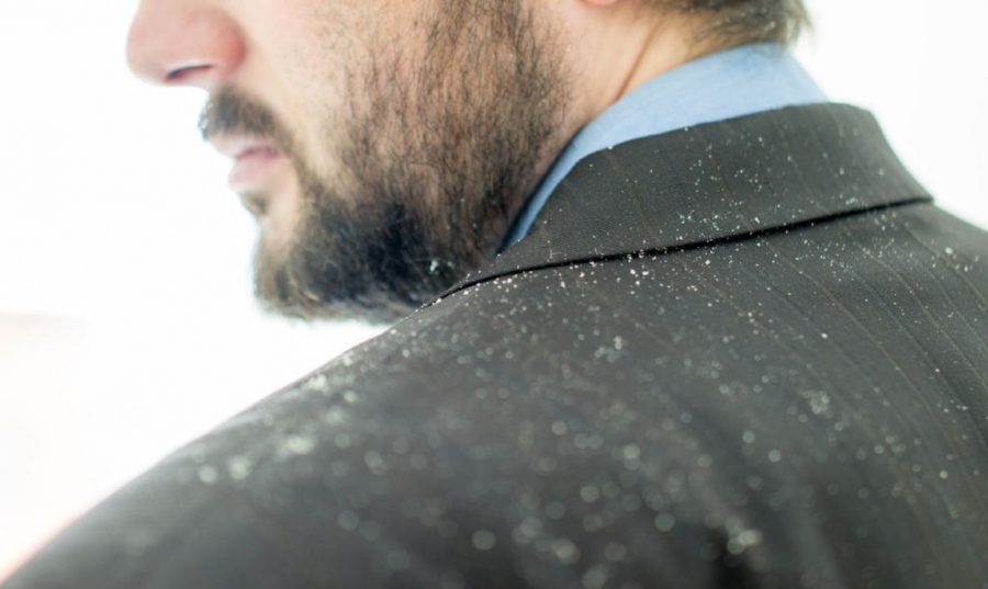 DANDRUFF shampoo ¿Provoca cáncer? 6 cosas que tienes que conocer del ...